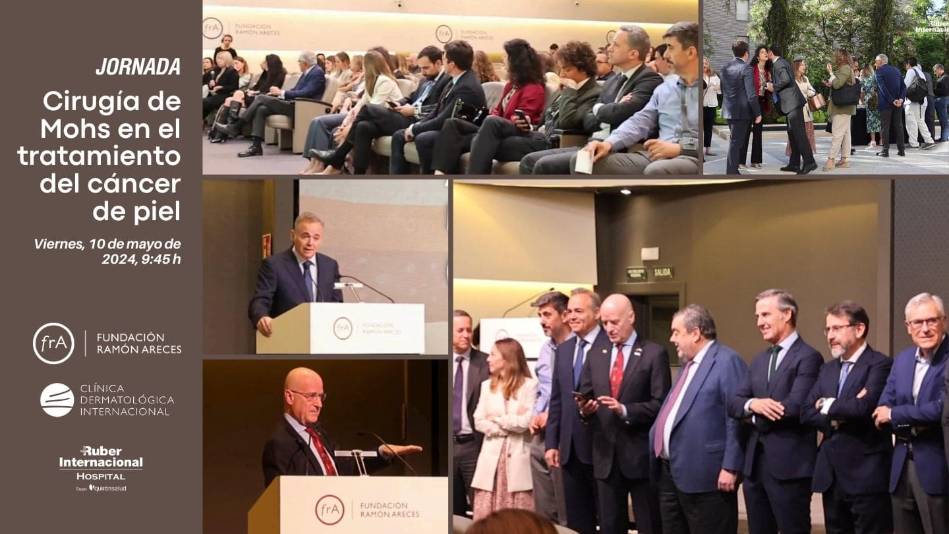 Cirugía de Mohs en el Tratamiento del Cáncer de piel | Jornada en Madrid